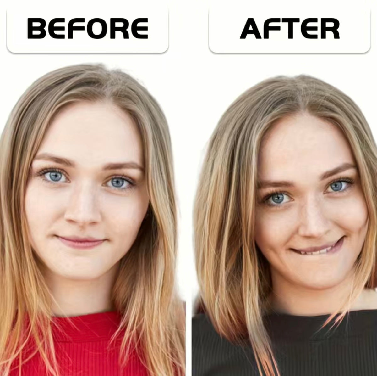 Overnight Dimple Makers- Clinical Grade Results At Home – NuYu Body ...